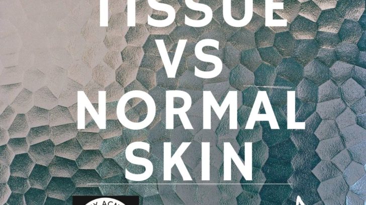 The Side Effects Of TCA CROSS for Acne Scars. - My Acne Scars