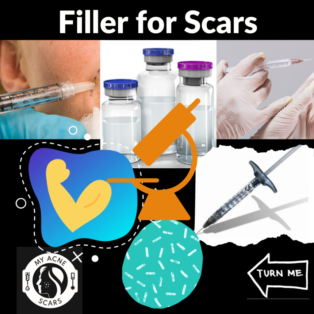 Filler For Acne Scars: Overview - My Acne Scars